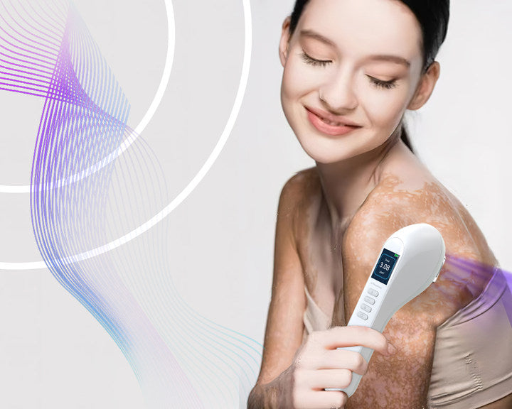 Combatting Vitiligo with Red Light Therapy