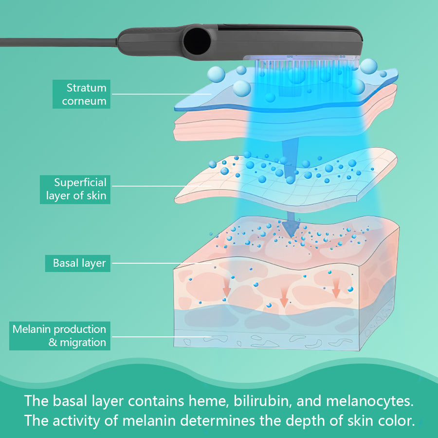 Best Narrowband UVB Light Therapy Device - Home Treatment For Psoriasis ...