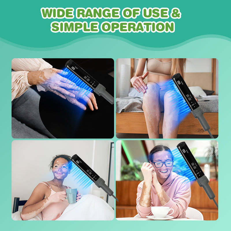 Best Narrowband UVB Light Therapy Device - Home Treatment For Psoriasis ...